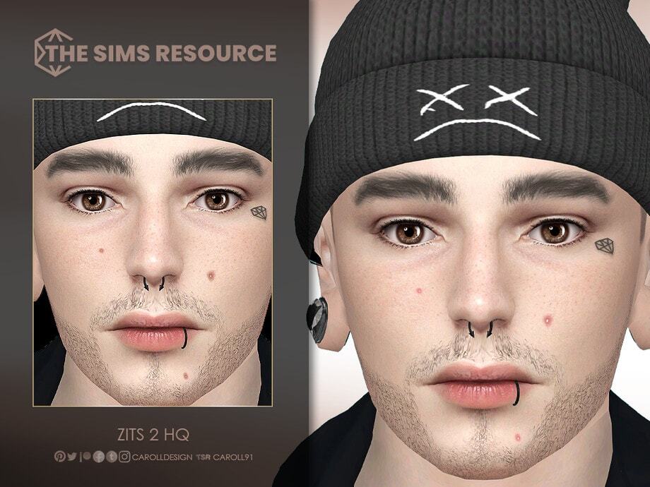 22+ Best Sims 4 Acne CC and Mods: Realistic Overlays, Breakouts, and ...