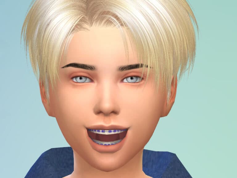 Must-Have Sims 4 Teeth CC: Normal, Supernatural, Gems, and Braces